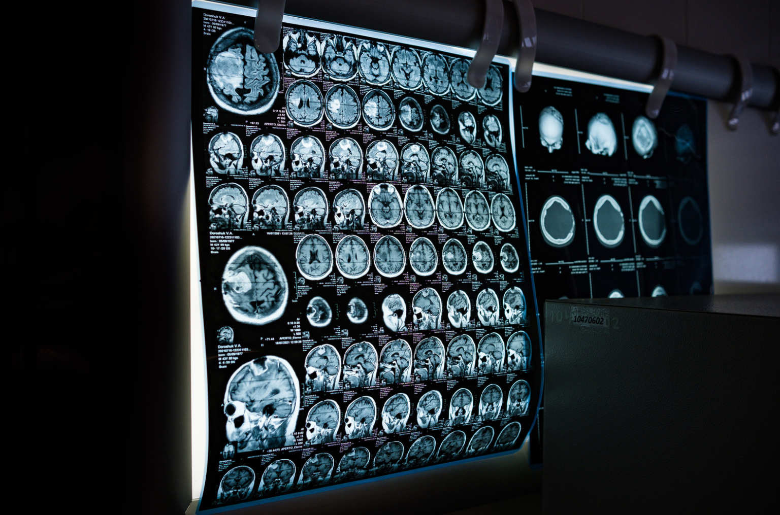 How Much Does An MRI Cost Without Insurance? - Insurance Noon