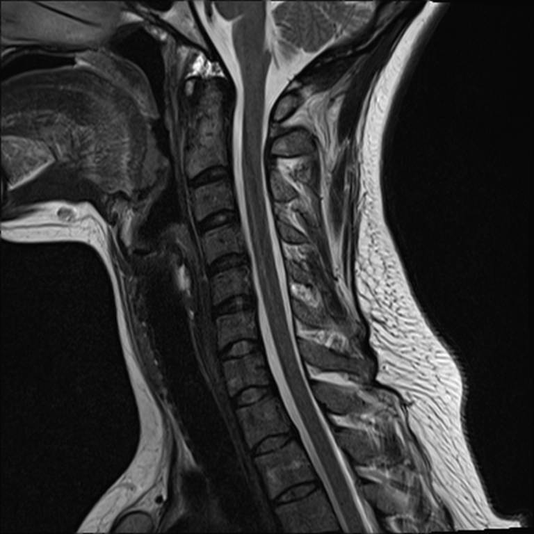 How Much Does An MRI Cost Without Insurance? - Insurance Noon